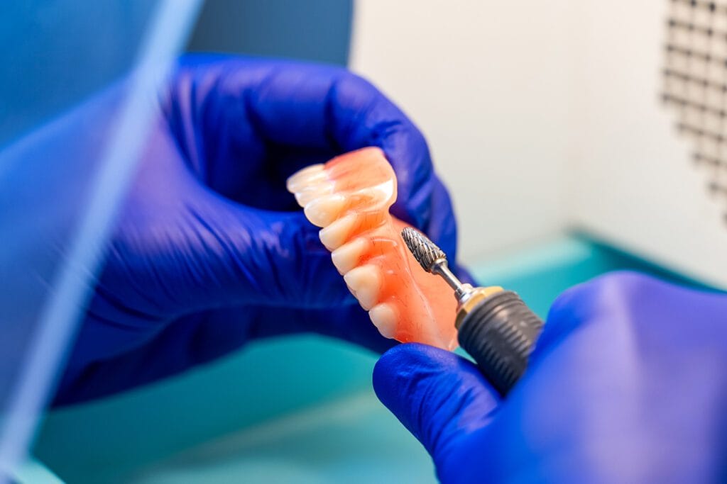 Denture Repair Services in Yakima & Spokane | Apex Dentures